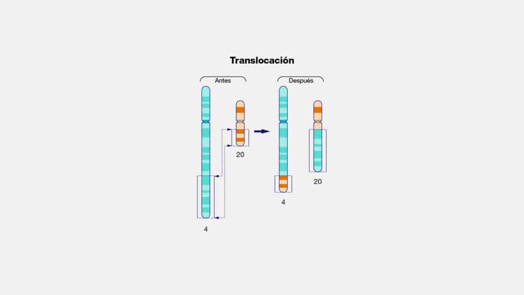 Translocacion – CROM – Instituto de Citogenética Humana